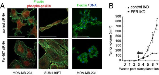 FER kinase - UMC Utrecht