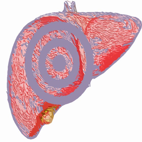 Horizon Europe Project LiverTarget gets funded - UMC Utrecht