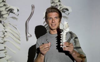 3D-geprinte wervelkolom - UMC Utrecht