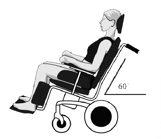 Herkennen en voorkomen van Decubitus - UMC Utrecht