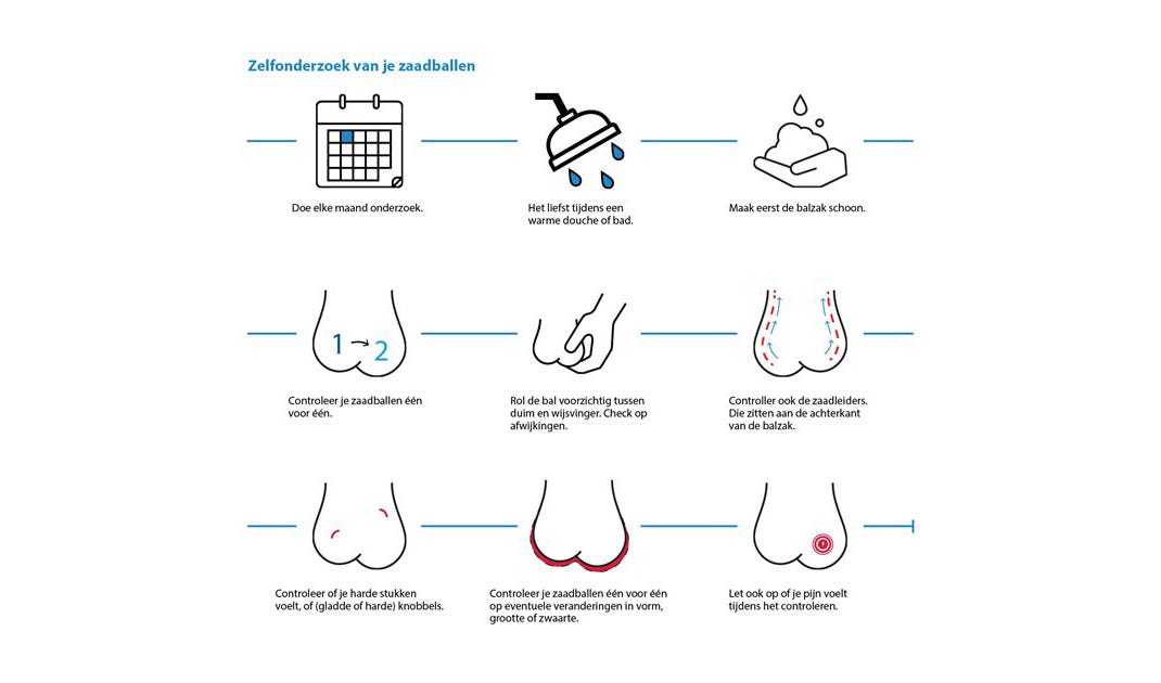 Zaadbalkanker - UMC Utrecht