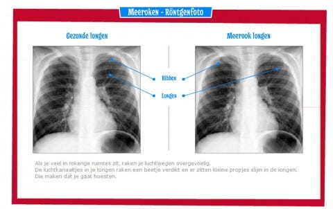 Algemeen - UMC Utrecht
