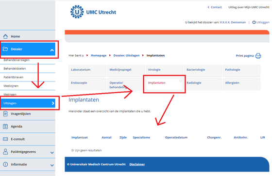 Landelijk Implantaten Register - UMC Utrecht