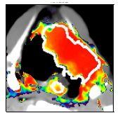 Molecular Imaging & Nuclear Medicine - UMC Utrecht