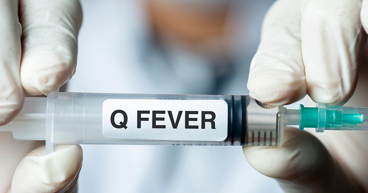 Nog steeds sterven mensen aan chronische Q-koorts - UMC Utrecht