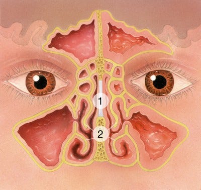 Neuscorrectie - UMC Utrecht
