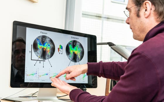 Brain-computer interfaces for paralyzed people - UMC Utrecht