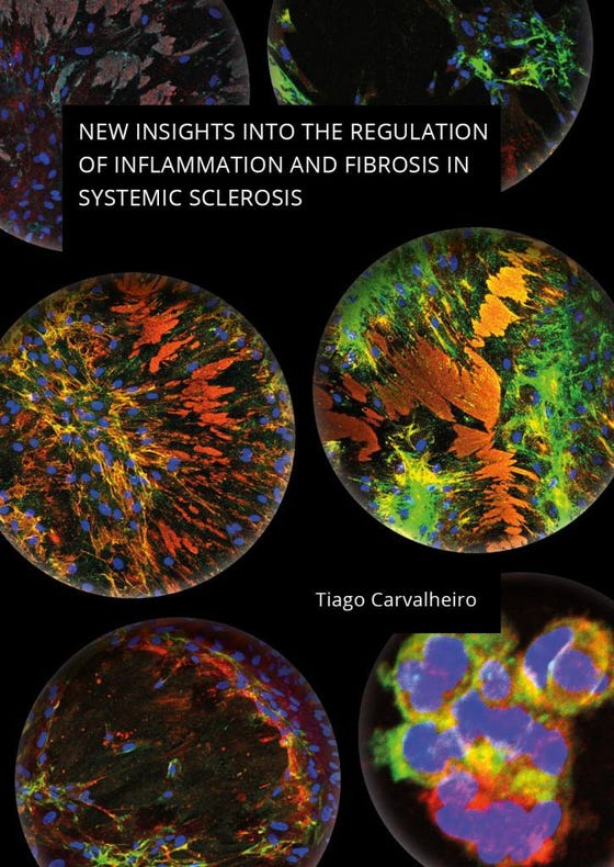 Feb 23: New insights in the regulation of inflammation and fibrosis in ...