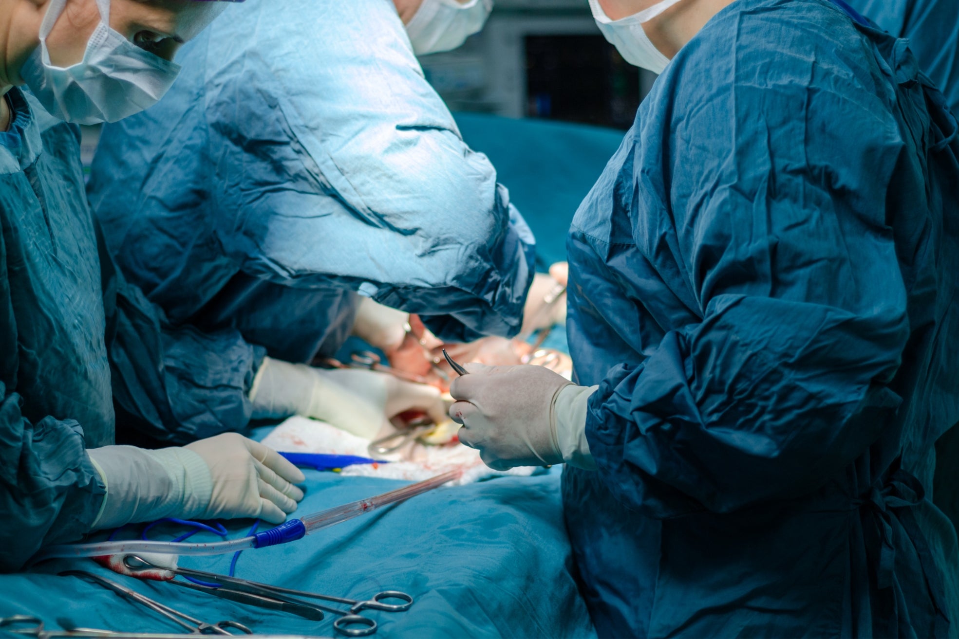 a surgical team performing an operation