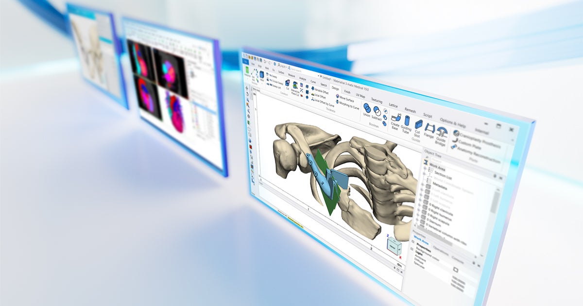 Materialise 3-matic Medical | Medical Device Design Software