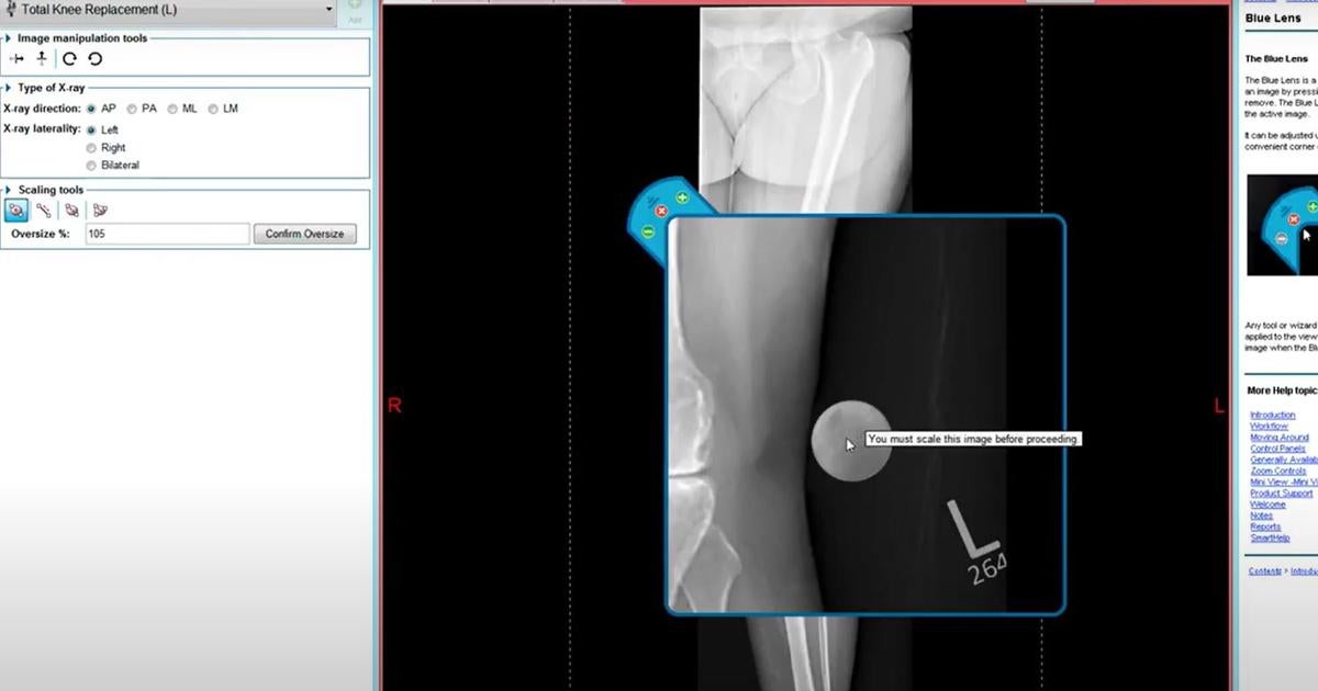 How to Scale Digital Images