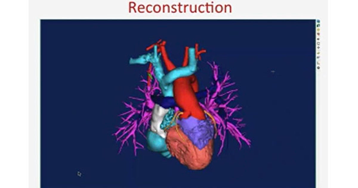 Transforming Medical Research with 3D Printing