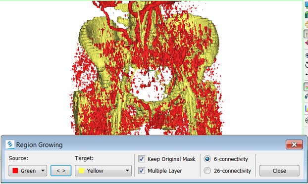 Mimics Tutorials, Webinars, and Training Courses | Materialise