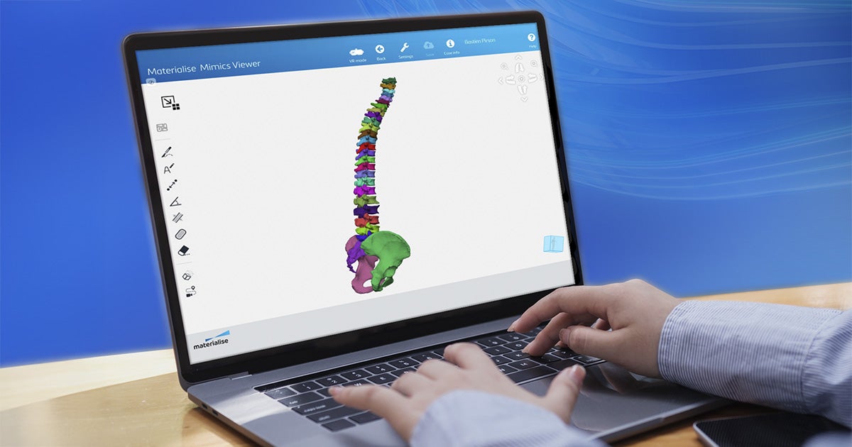 Segmentación Automática Basada en IA | Materialise Mimics