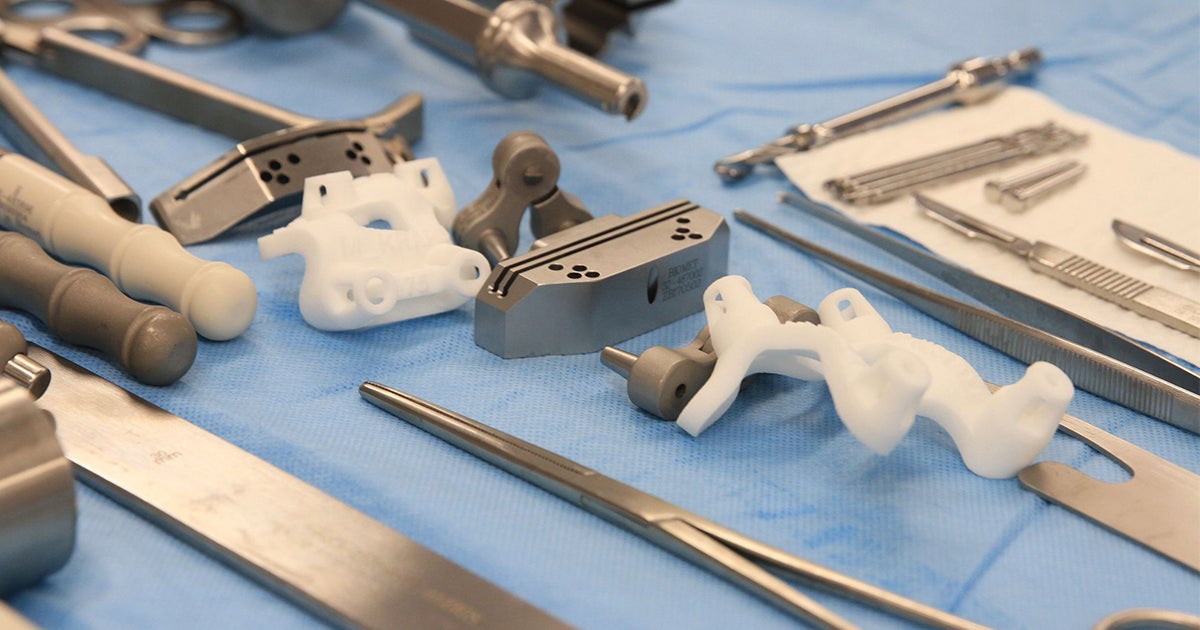 30 Years of Materialise: Revolutionizing Healthcare Engineering