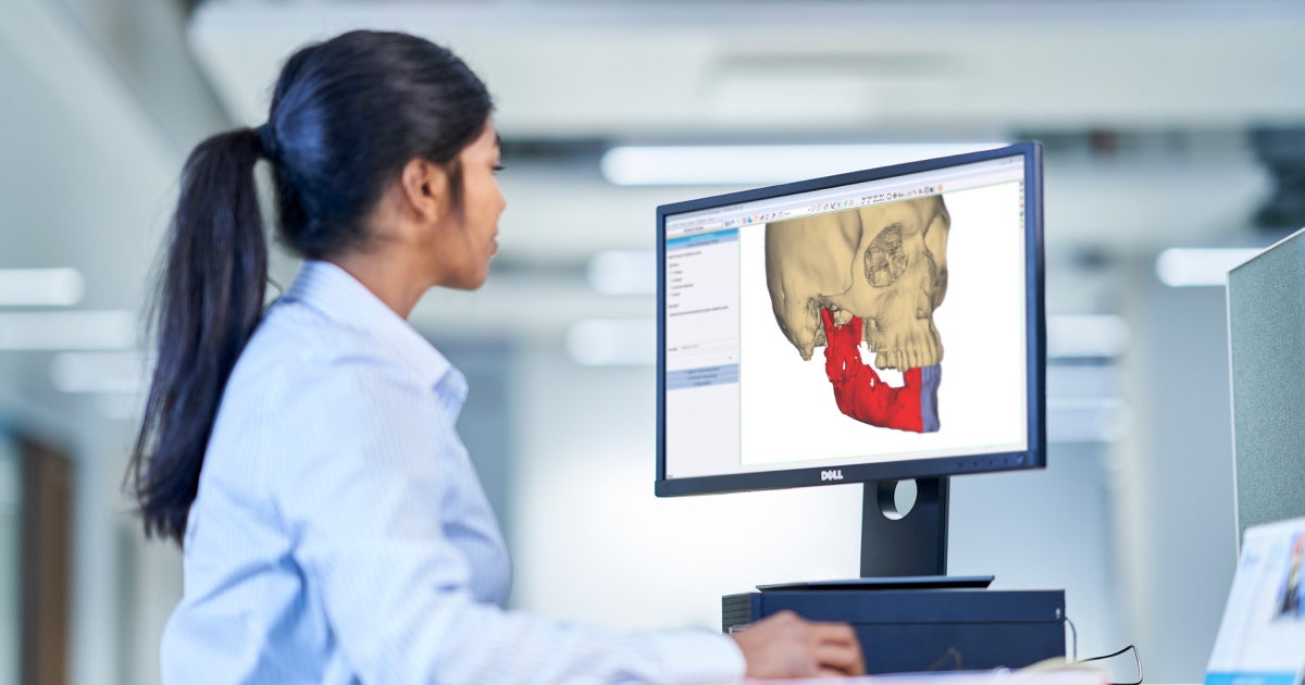 PROPLAN CMF™ | Virtual Planning for CMF Surgery