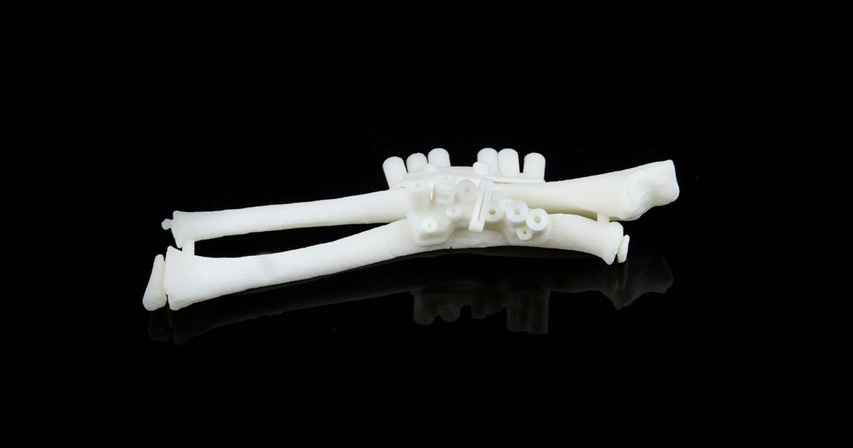 3d Printed Bones Pros And Cons