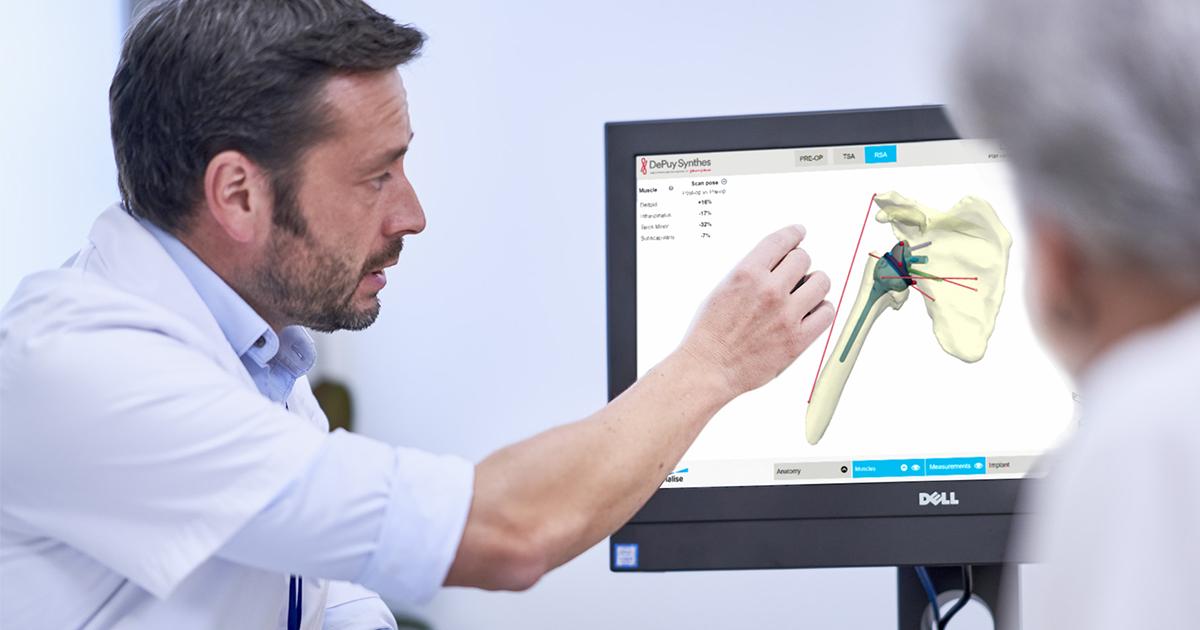 Mimicking the Shoulder Joint’s Dynamic Nature with Muscle Simulation