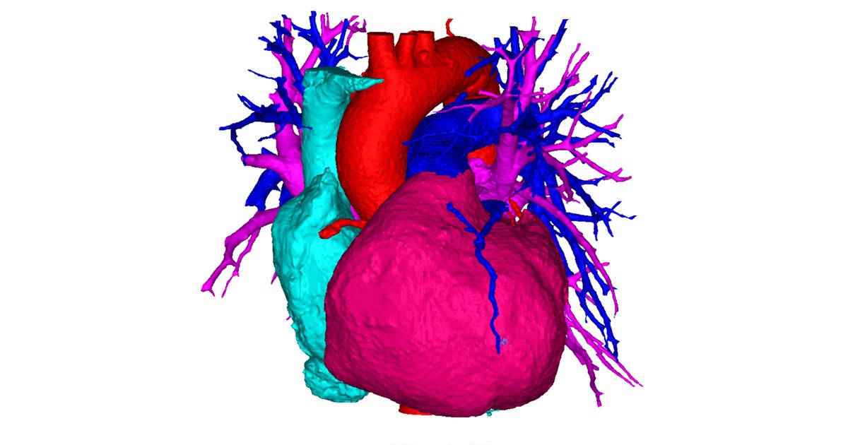 Mimics AI-enabled CT Heart Tool for Heart Chamber Segmentation