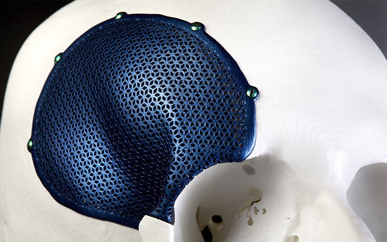 35 Years of Making a Difference: Innovating for a Healthier Tomorrow