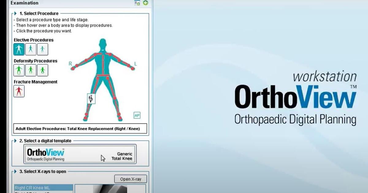 Tutorial: Examination Panel in Materialise OrthoView