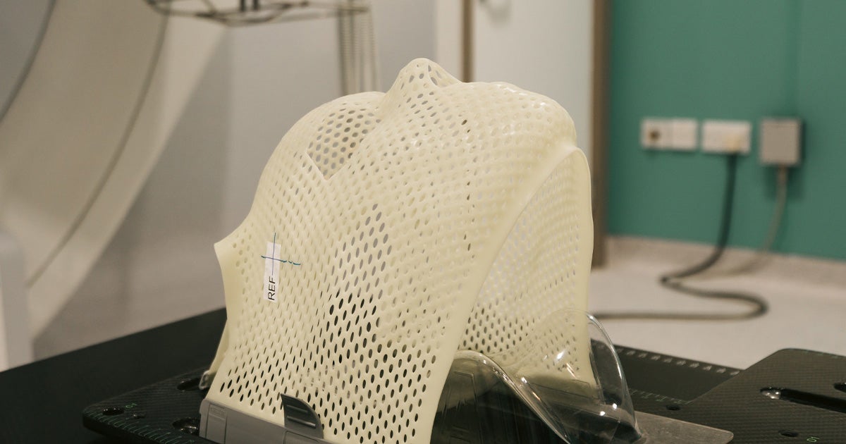 Why 3D Printing Offers Radiotherapy Tremendous Potential