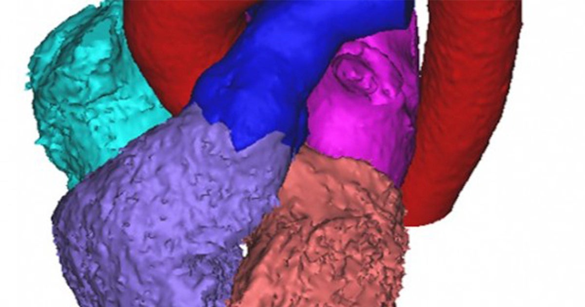 Tutorial Automatic Heart Segmentation Using Ct Heart Tool