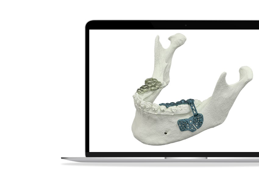 Webinar: New Trends for Minimally Invasive Approaches in CMF Surgery