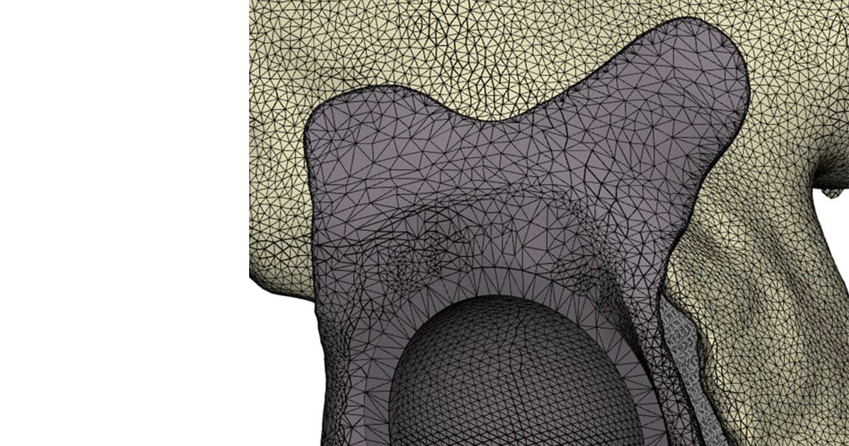 5 Tips to Optimize Personalized Medical Device Design