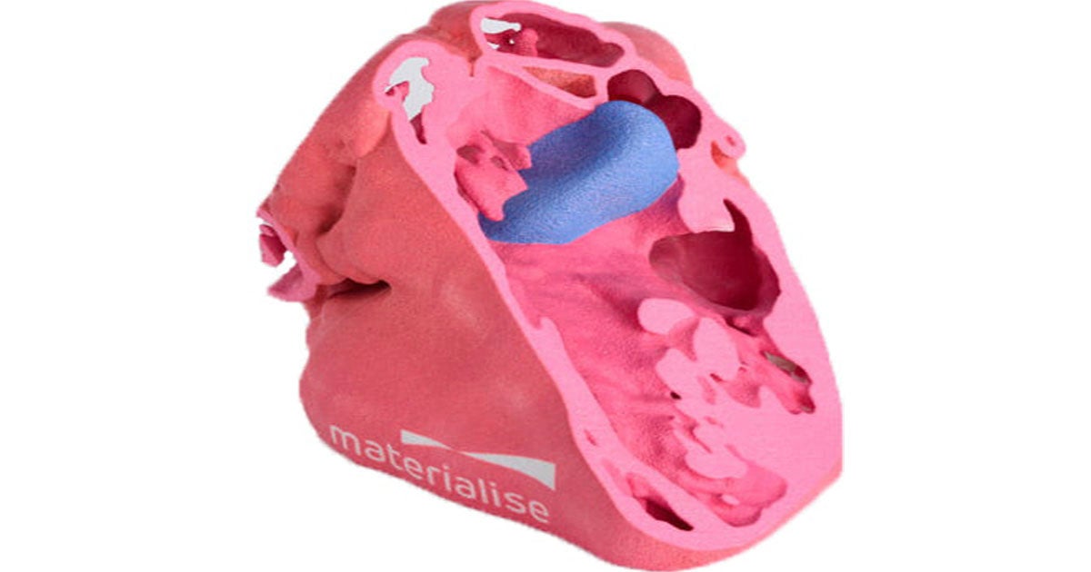 Materialise erweitert Zusammenarbeit mit HP zur Förderung industriellen ...