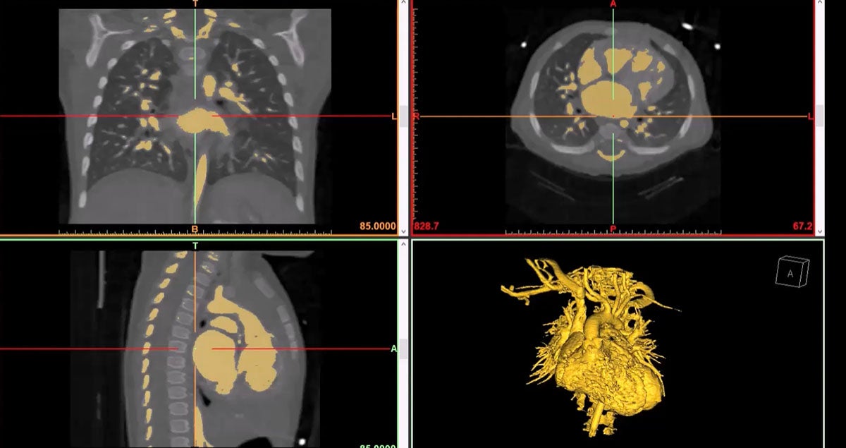 Mimics inPrint ビギナー向けウェビナー vol.1 基本操作