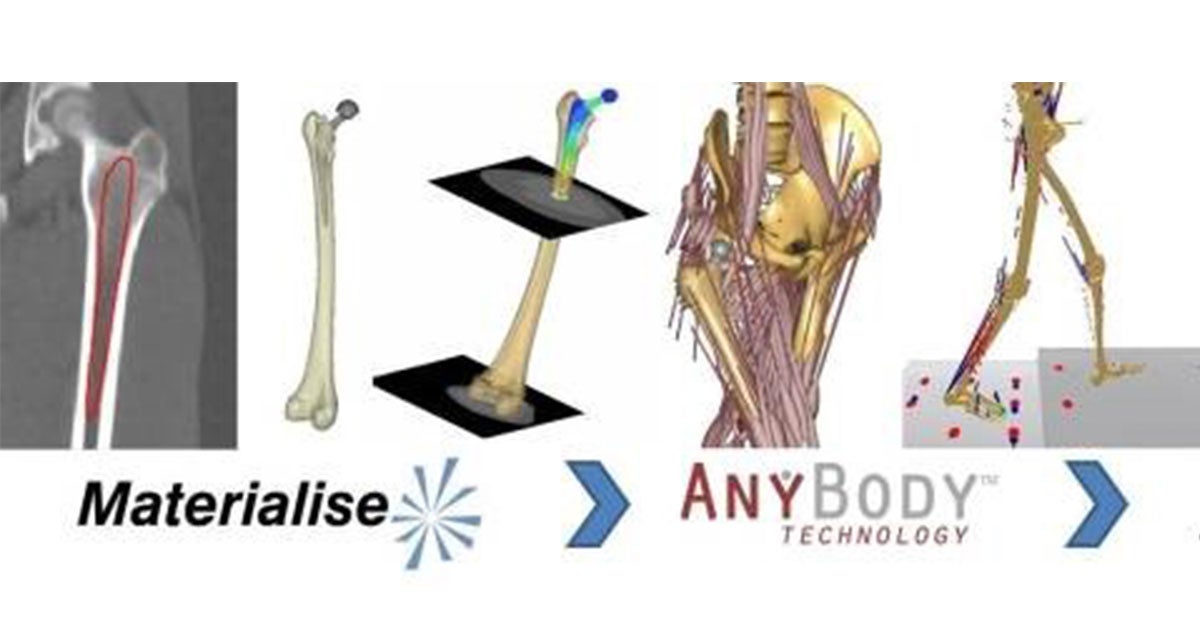 Webinar: Advancing FEA Design through Patient-Based Motion Analysis