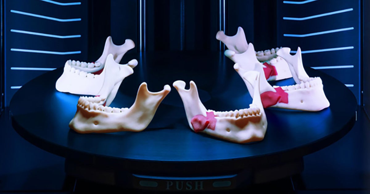 CMF Surgery Innovations with Materialise Certified Medical Software and ...