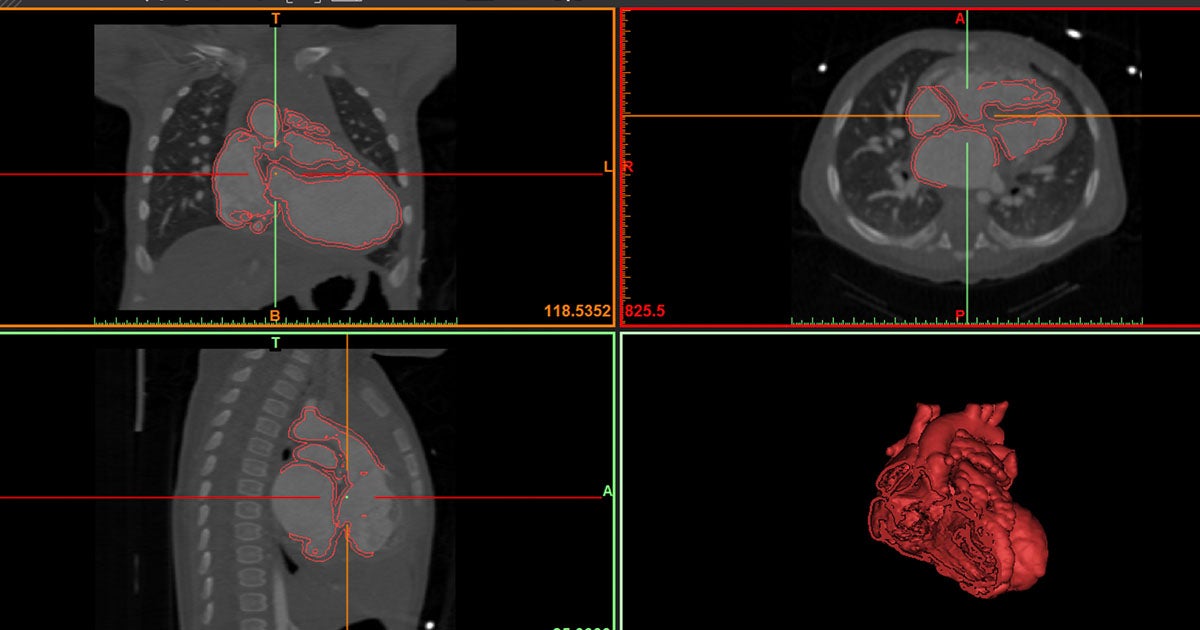 Tutorials | Mimics InPrint | Materialise Academy