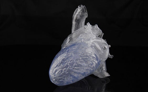 Creating the Perfect Fit for a Pulsatile Total Artificial Heart