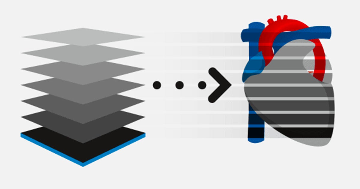 Whitepaper: 4D CT Heart Tool for Left Heart Chamber Segmentation