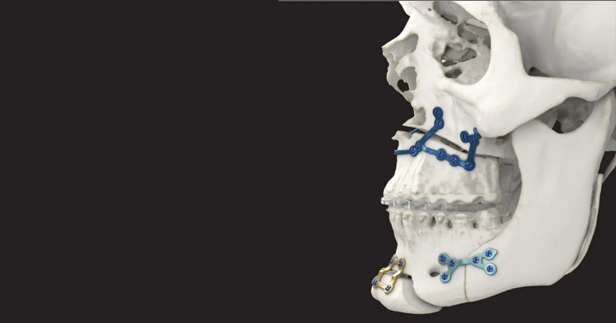 Orthognathic Solutions