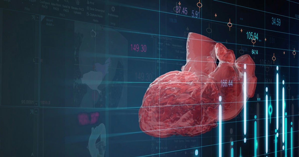 How Automation Helped FEops Accelerate Structural Heart Planning