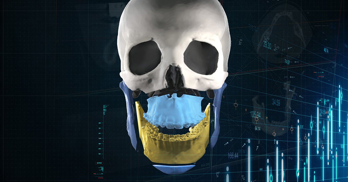 Materialise Mimics Enlight CMF | Virtual Surgical Planning Materialise Mimics Enlight CMF | Virtual Surgical Planning