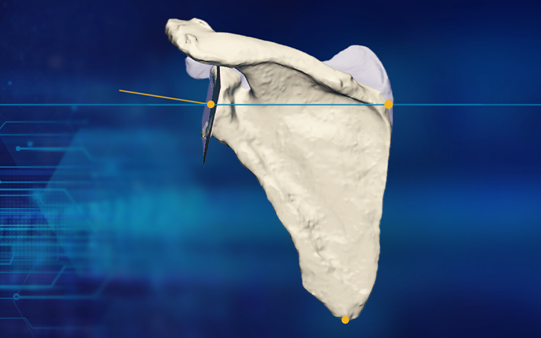 Materialise Orthopaedic Solutions Brochure