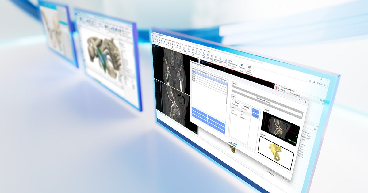 Materialise Mimics를 위한 Generic 리포팅 플러그인 다운로드