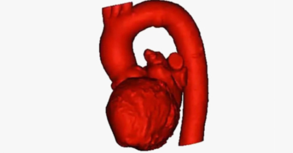 Tutorial: Create a 3D-Printable Model of the Heart and Myocardium