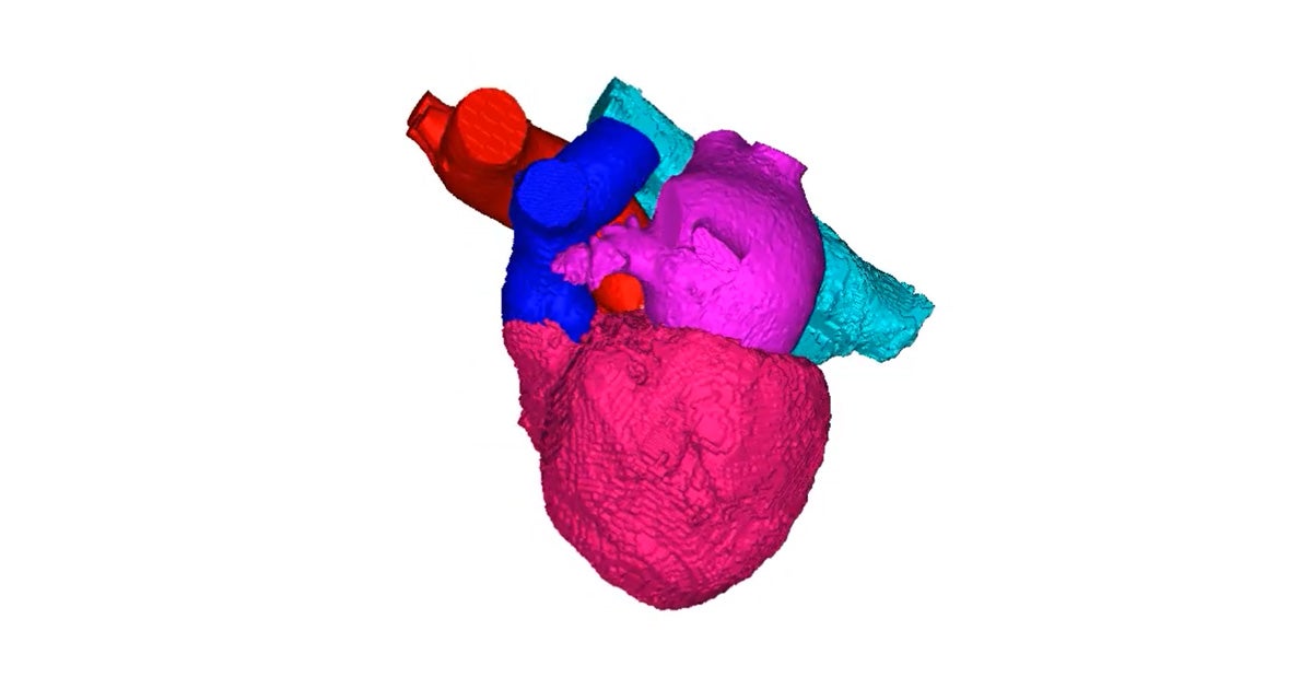 Tutorial: How to Segment the Heart with the CT Heart Tool
