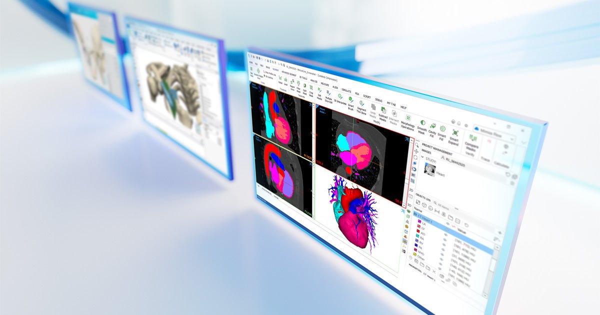Materialise Mimics Core | 3D Medical Image Segmentation Software