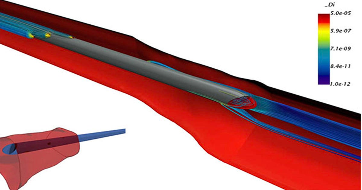 Toward In Silico Clinical Trials: Evaluating Medical Device Performance ...