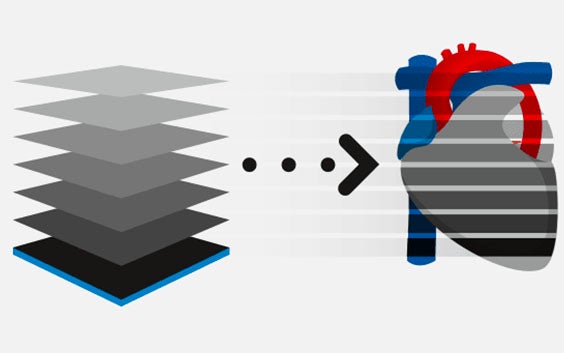What’s New in Imaging: 3D Planning for Structural Heart Interventions