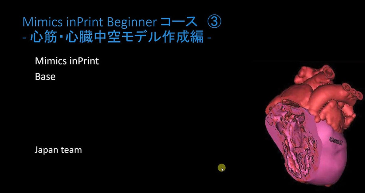 Mimics inPrint ビギナー向けウェビナー vol.3 心筋・心臓中空モデルの作成