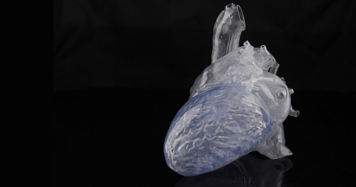 Creating the Perfect Fit for a Pulsatile Total Artificial Heart
