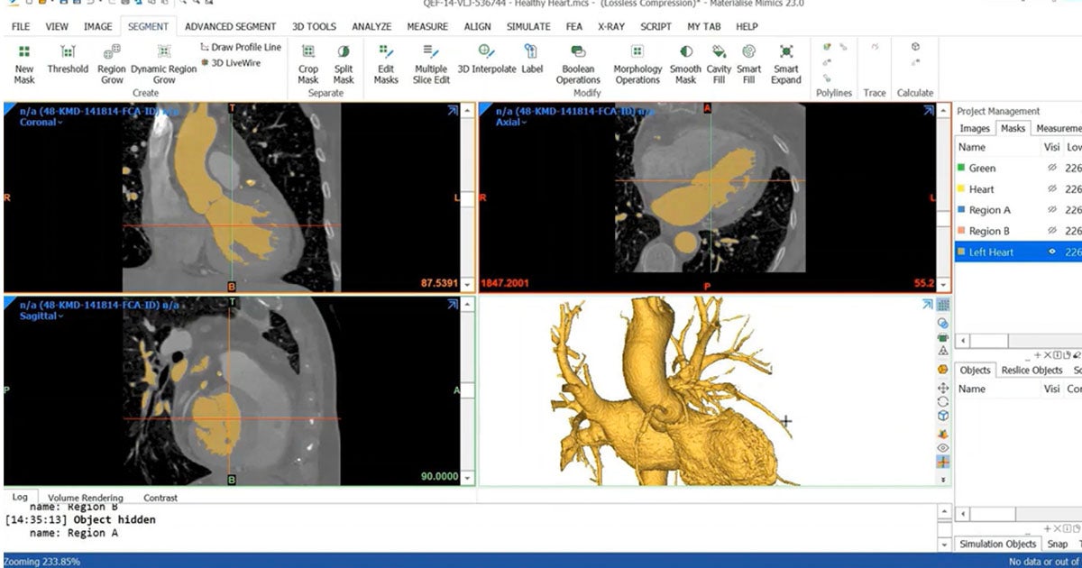 Image-to-Implant: Essential Design and Manufacturing Considerations in ...