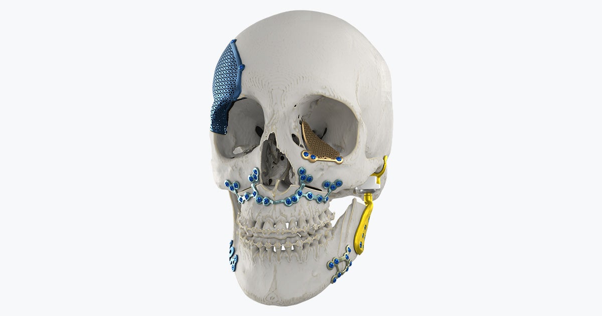 Cranio-Maxillofacial Surgery Knowledge Hub | Materialise Academy